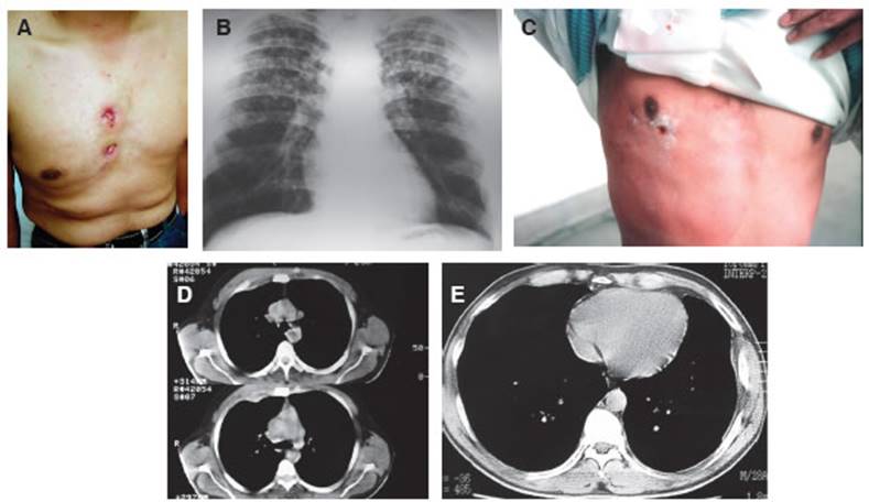 RAMR - Volumen 21, Número 4 - Consideraciones sobre afecciones de la ...