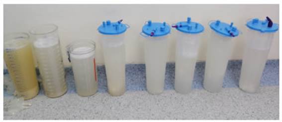 RAMR - Volume 22 Number 4 - Whole Lung Lavage Protocol at Hospital ...