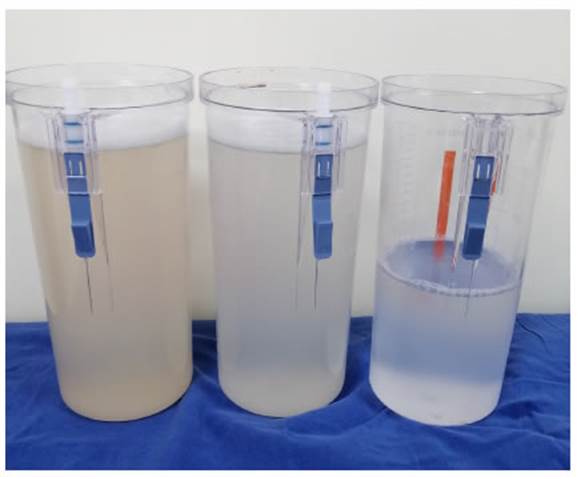 RAMR - Volume 22 Number 4 - Whole Lung Lavage Protocol at Hospital ...